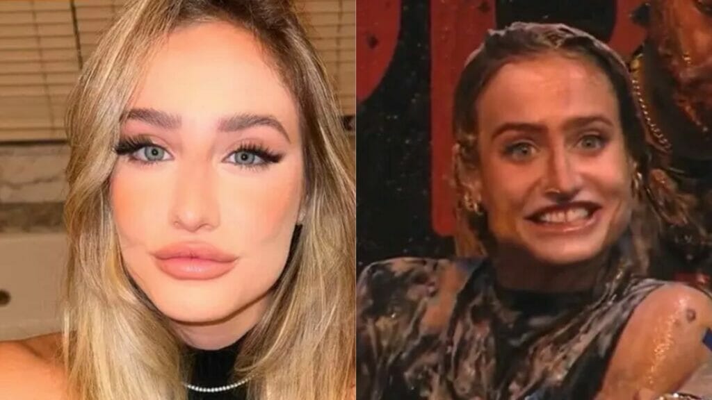 Cirurgias: Antes e depois de Bruna Griphao, do BBB 23
